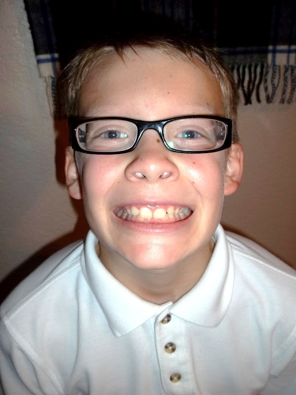 Williams Family: Big Boy Teeth