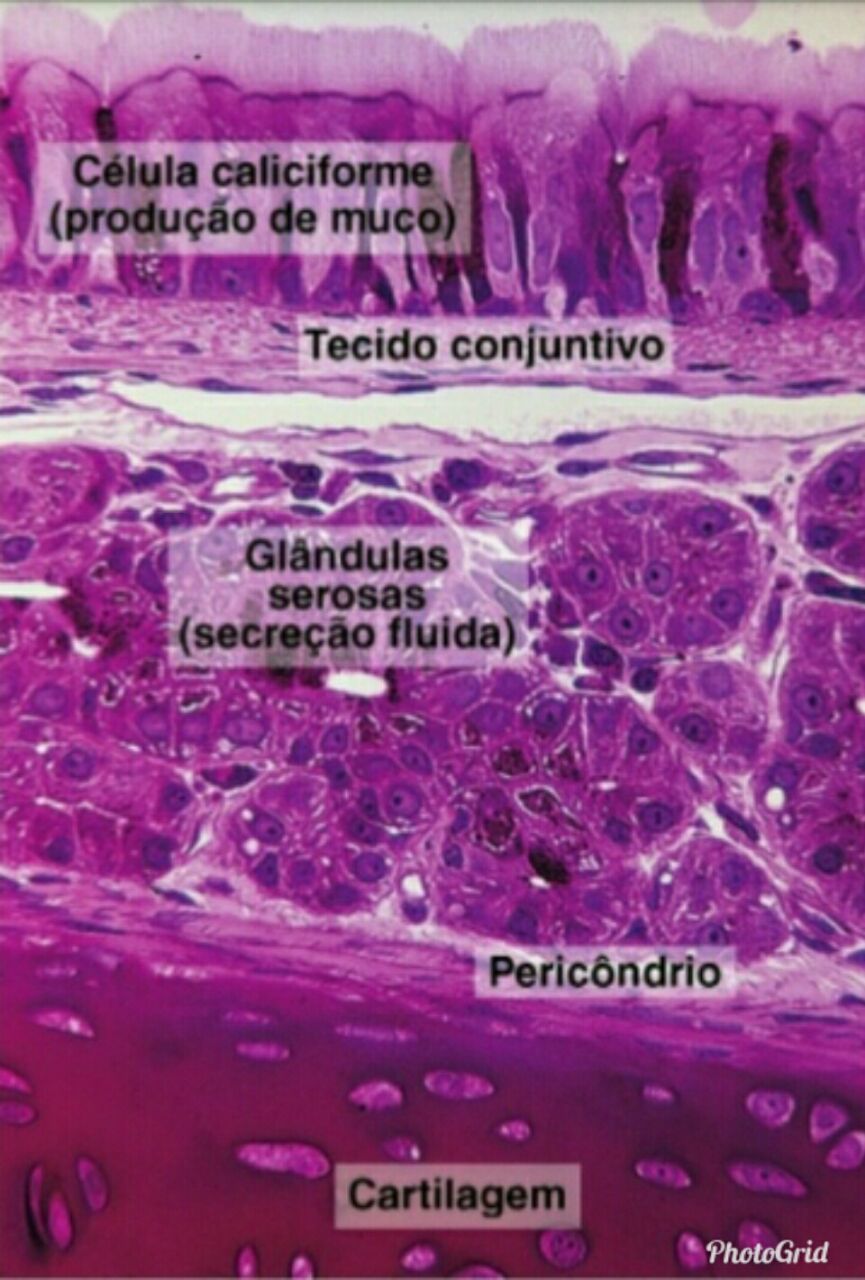 Saúde e a química da célula humana: CÉLULAS CALICIFORMES E DOENÇAS ...