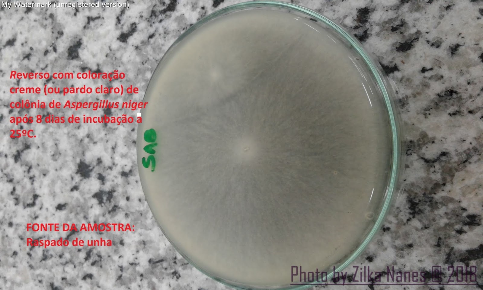 3. FUNGOS FILAMENTOSOS