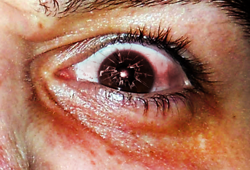 ObtuZoom: Inféctate, especial Halloween.