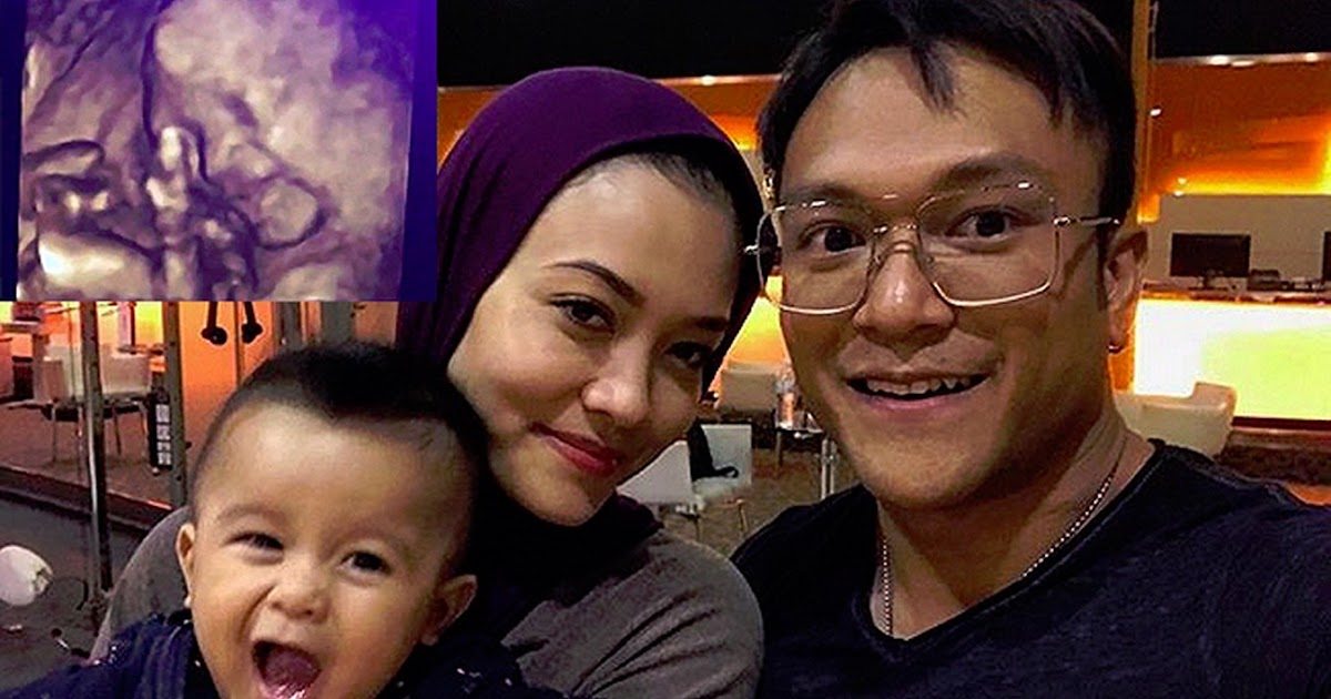 MYARTIS.COM | MYARTIS | MY | ARTIS: SYATILLA MELVIN KONGSI FOTO IMBASAN, UMUM ANAK KEDUA 'GIRL'