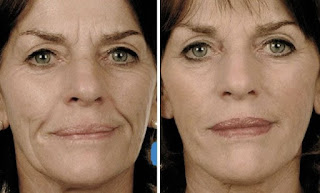 Face Toning Workouts Towards A Natural Nodal Facelift: Exercises For ...