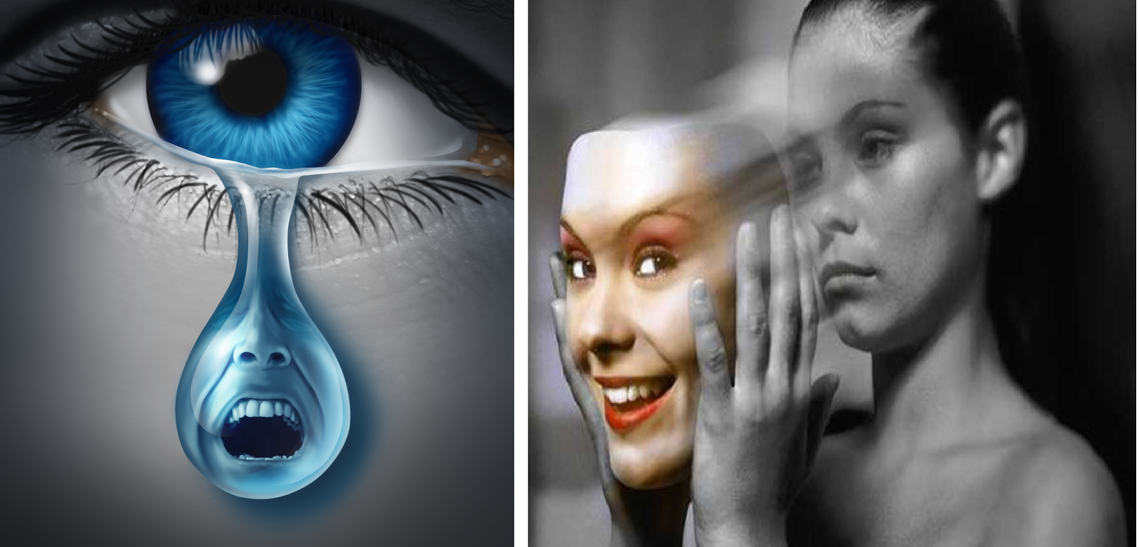 Síntomas en la Depresión Unipolar vs Síntomas en la Depresión Bipolar ...