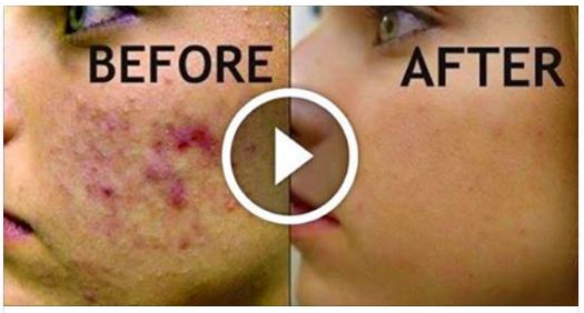 Naturally Effective Skin Whitener That You Can Do At Home! MUST TRY ...