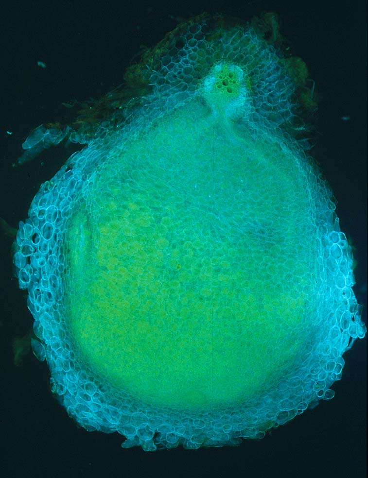 Beyond the Human Eye: Bacterial Root Nodules