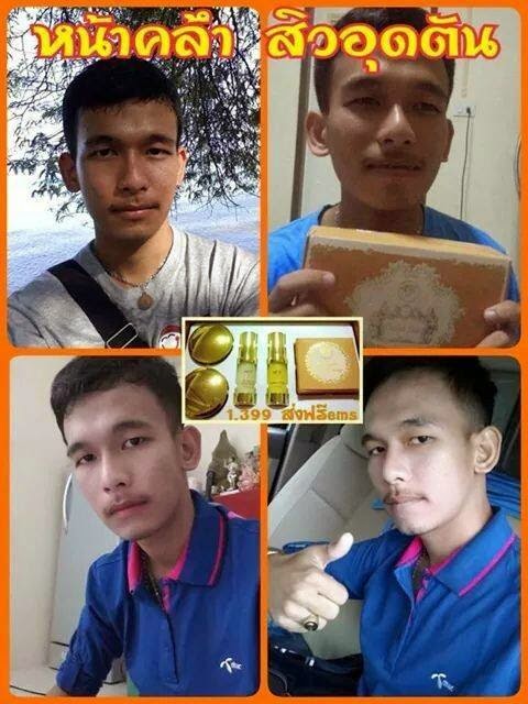 Thailand Beauty Products: Before And After Using Freshy Face Gold Set