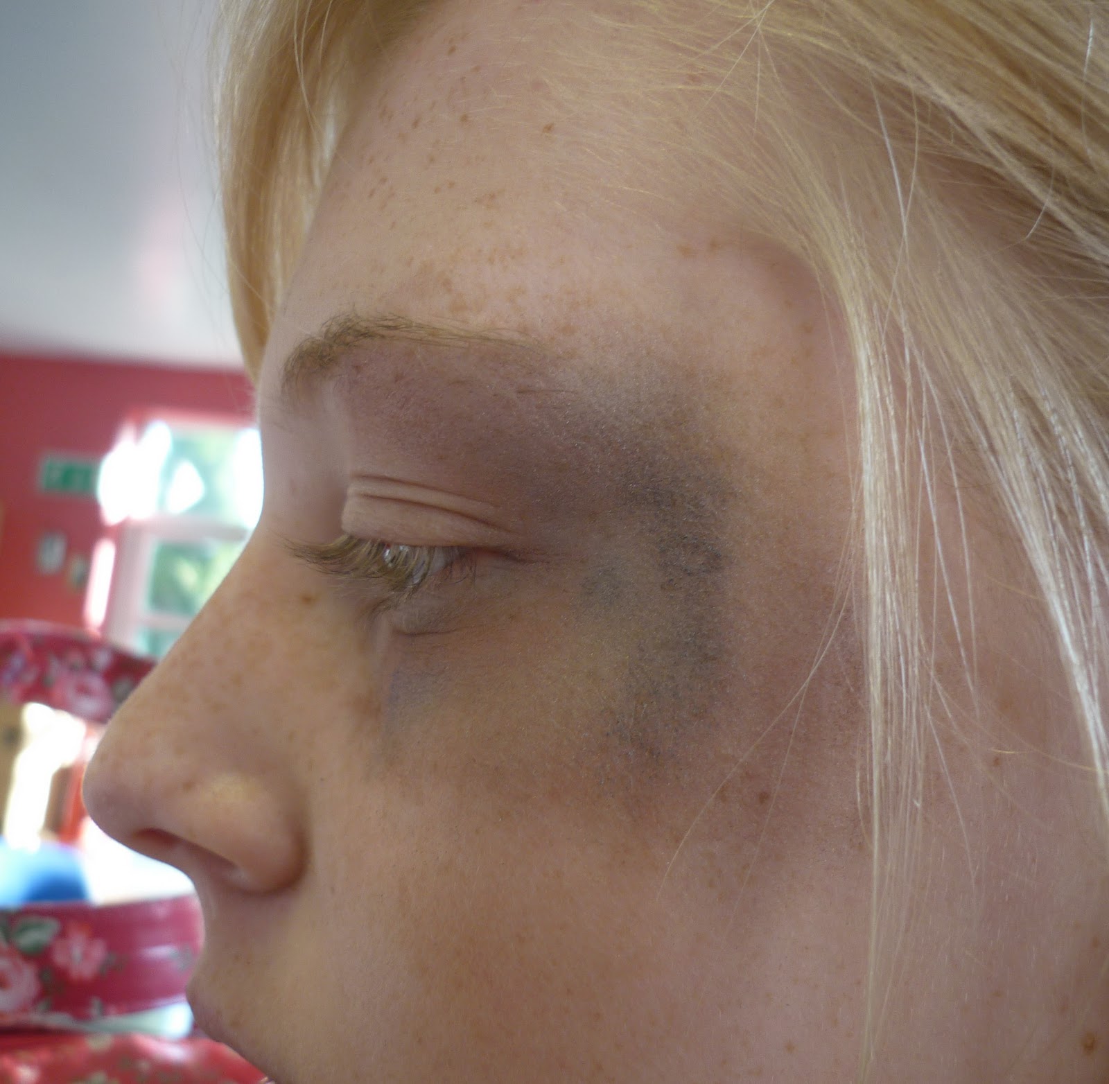 REMOTE DEATH: Bruise Make Up