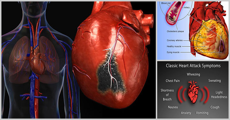 Warning Signs Of A Heart Attack Before It Happens | Dr Farrah MD