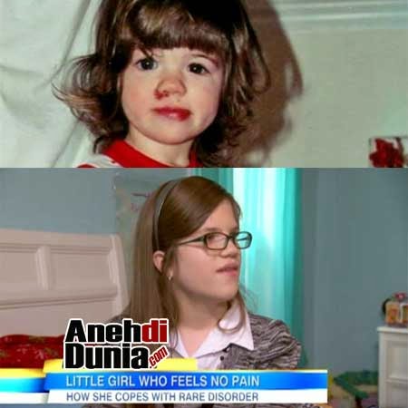 Manusia Yang Tidak Mengenal Rasa Sakit - Oplozite