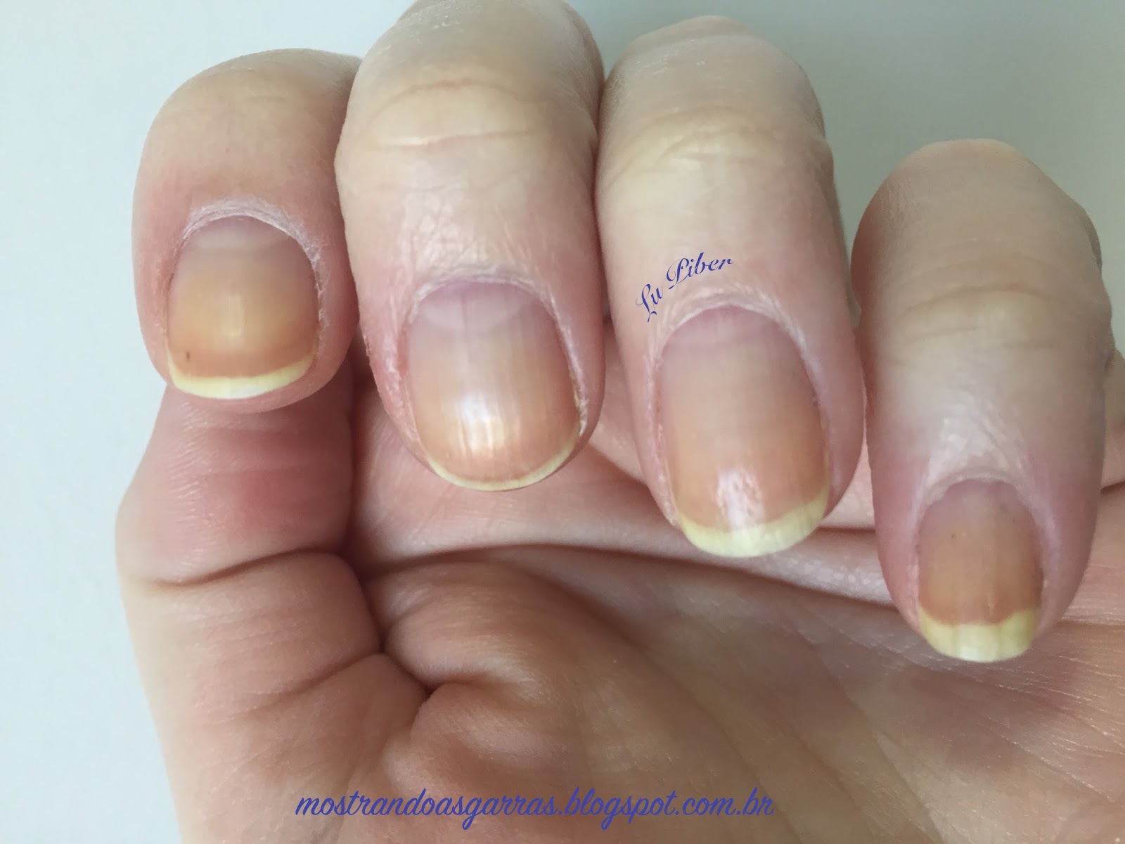 Mostrando as Garras : Recuperando as Cutículas