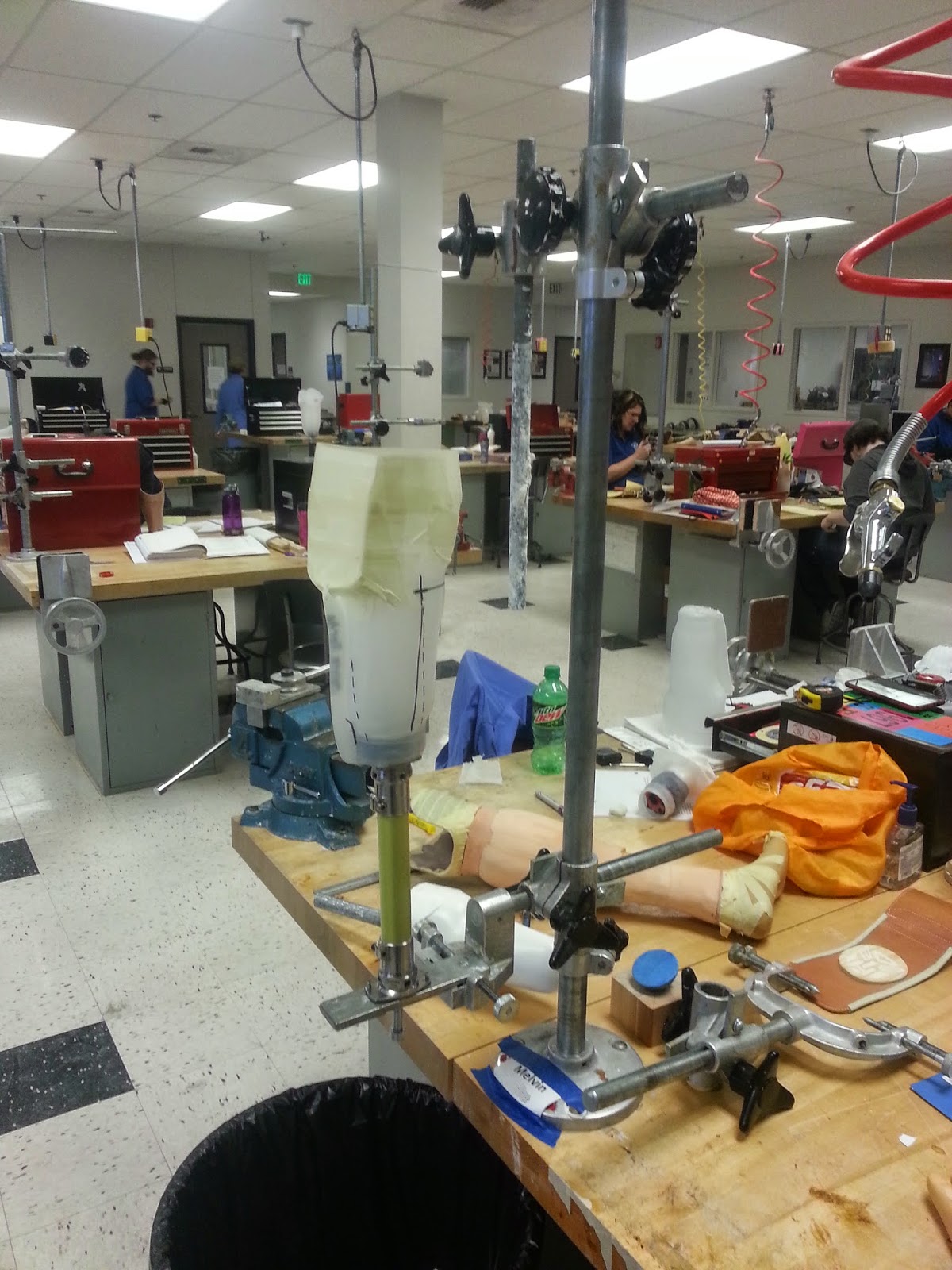 Prosthetic Projects: Locking liner Carbon Fiber transtibial ...