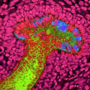 Scientists create 'mini-kidneys' from human stem cells | NextBigFuture.com