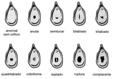 Ciências e Sexualidade: Virgindade e hímen