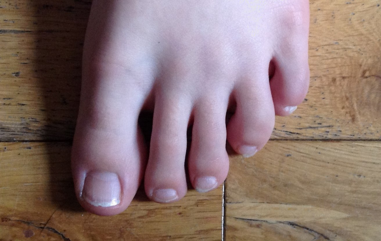 Why Didn't I Stick to Dogs?: Toes