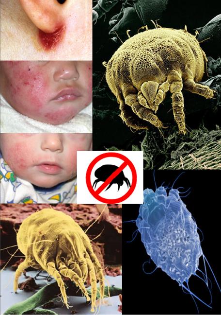 Purple Plum Fairy: Dealing with Dust Mites