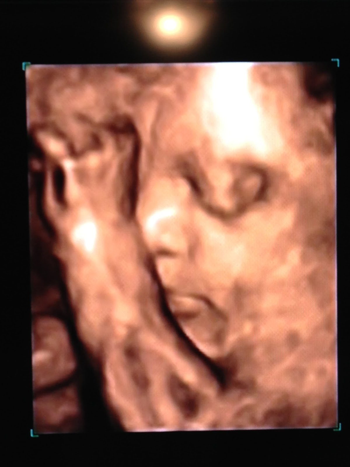 The Spurrier Family: 28 Weeks: 3D/4D Ultrasound Pictures