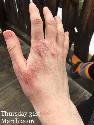 Hand-some | TSW Cara