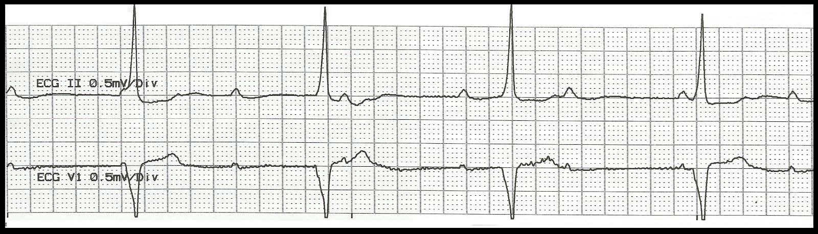 Practice EKG Rhythm Strips 173