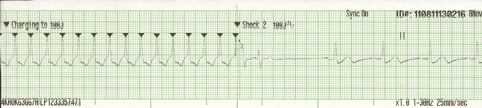 ACLS Review Questions