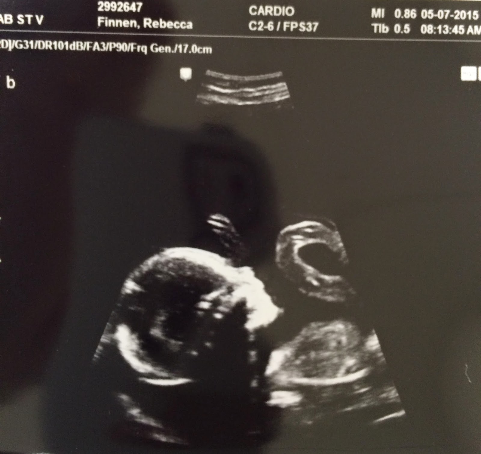 The Finnen Five: Level 3 Ultrasound