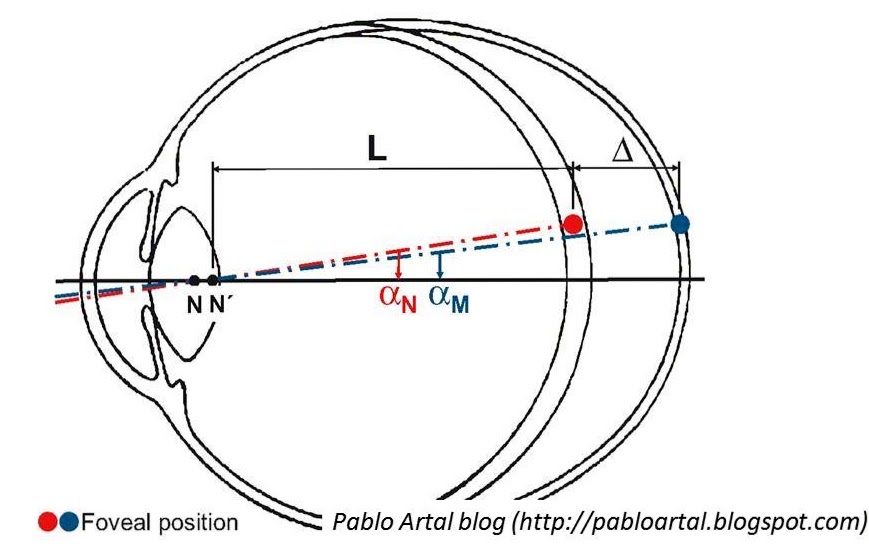 Pablo Artal Blog: Why kappa angle is larger in hyperopic eyes?
