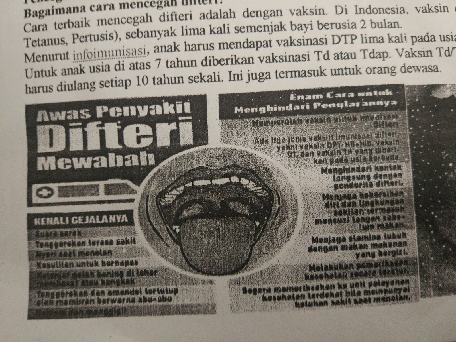 Penyakit difteri gejala dan penyebabnya faktor pemicu