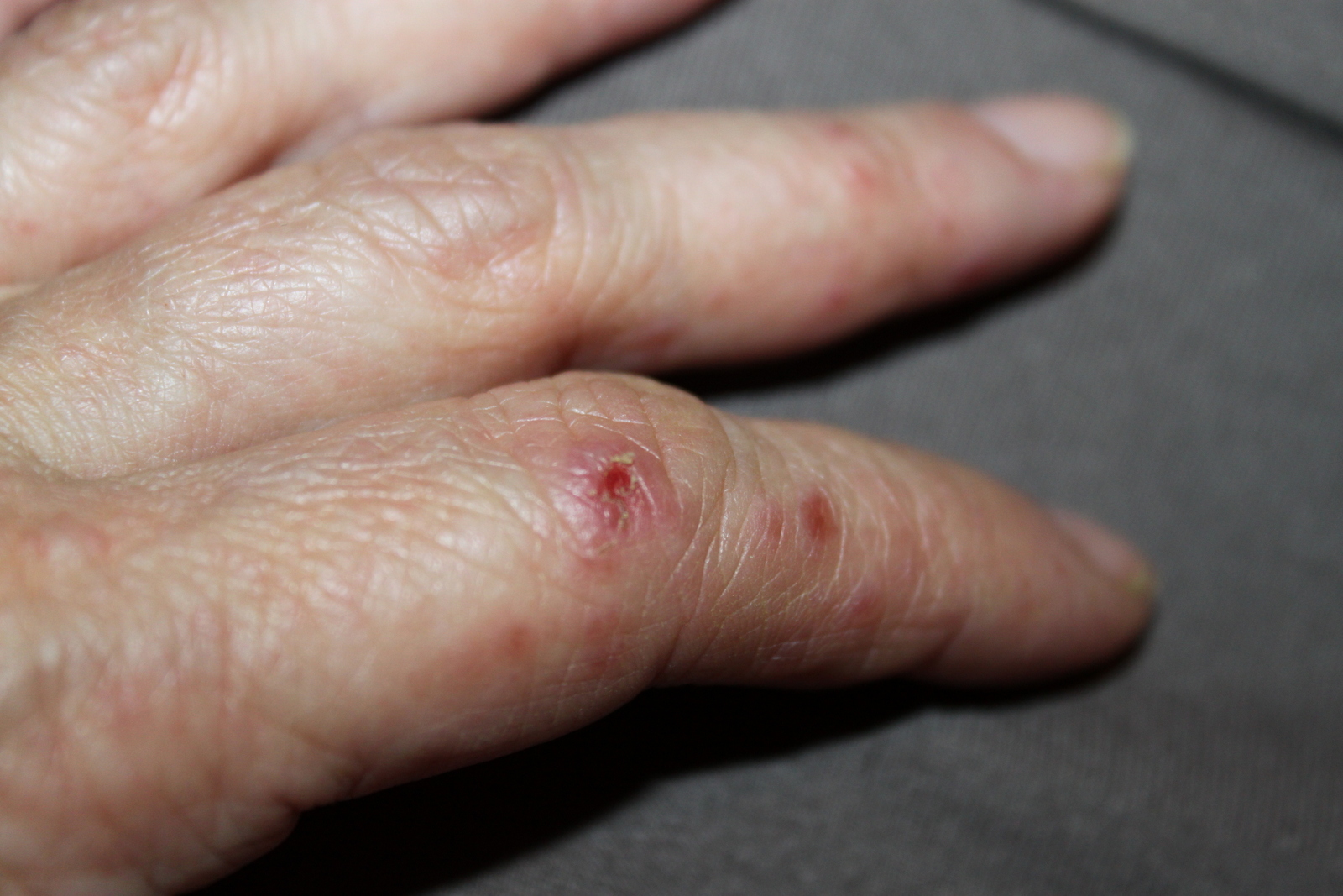 Koti koirakarvoil: Mummul o enterorokko