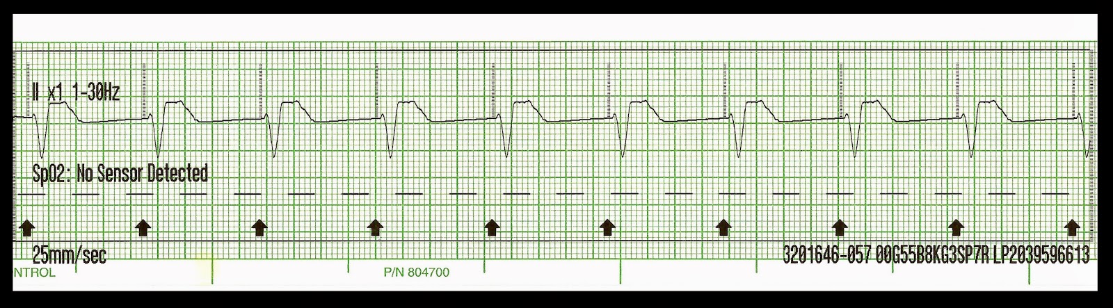 ACLS Questions