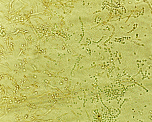 Sustainable Mycology: Wallemia mycotoxin