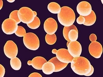 Jenis-Jenis Fungi dan Peranannya | Vilya Han