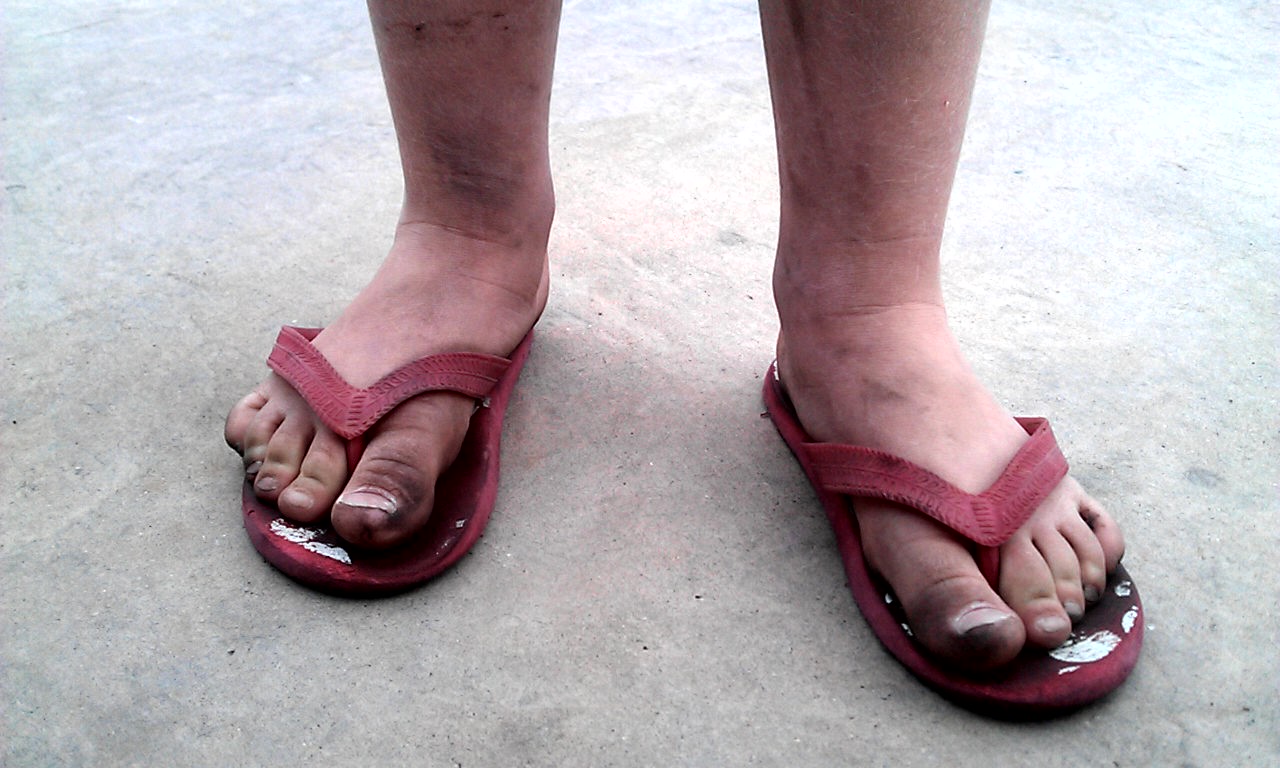 Haynes Family Yard Sale: Want to see some gnarly feet?