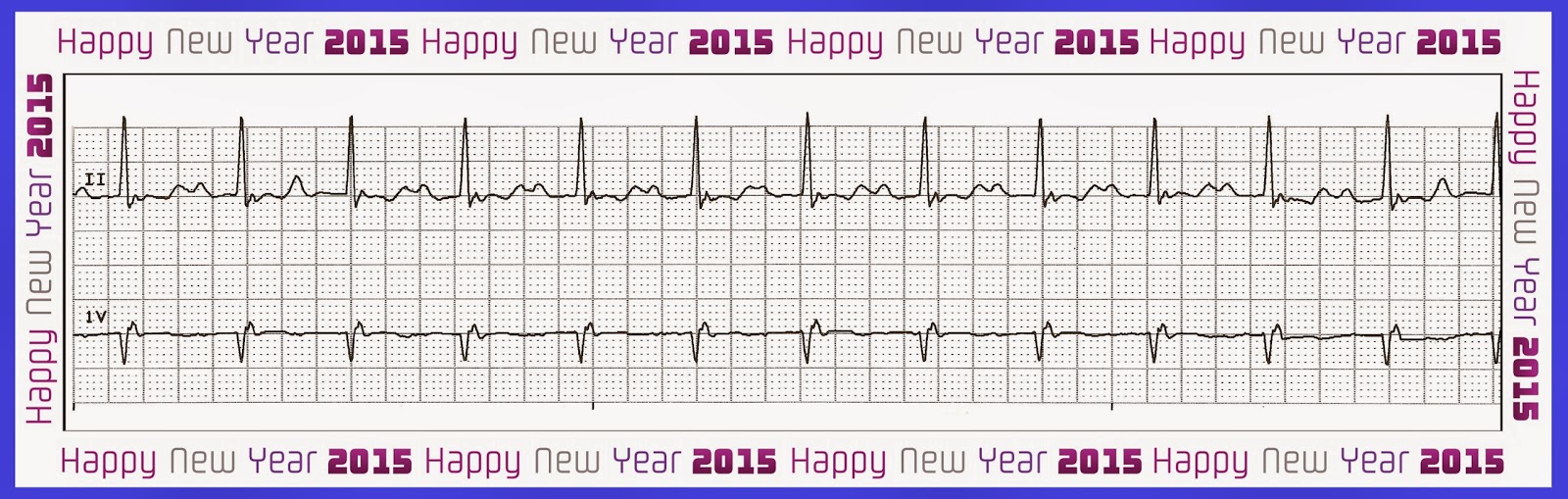 Practice EKG Strips 379 HAPPY NEW YEAR
