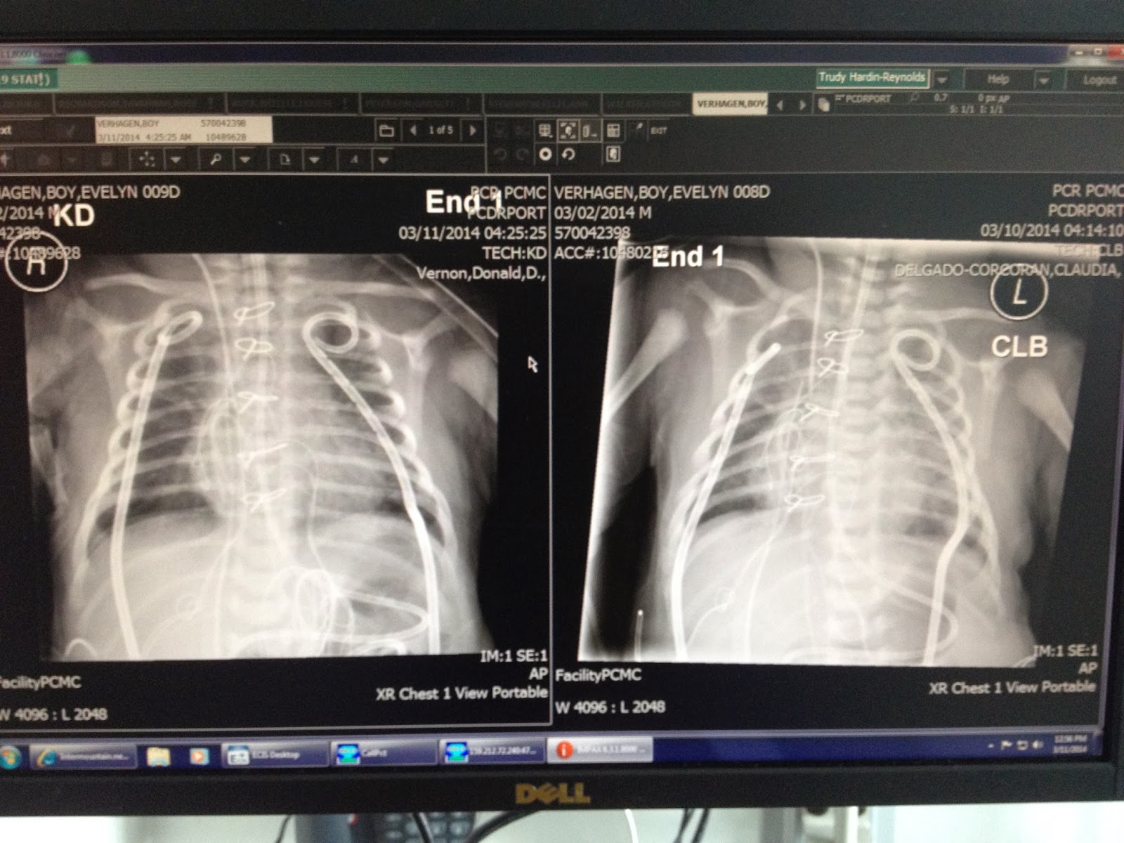 Levi Aaron: The Scar that Represents Life