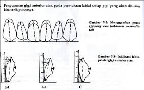 Penyusunan Gigi Mata Kuliah GTL | Today should be better than yesterday