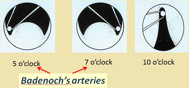 How to perform TURP? (post) step-by-step operative urology series