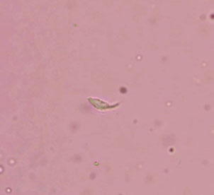 Creepy Dreadful Wonderful Parasites: Answer to Case 267