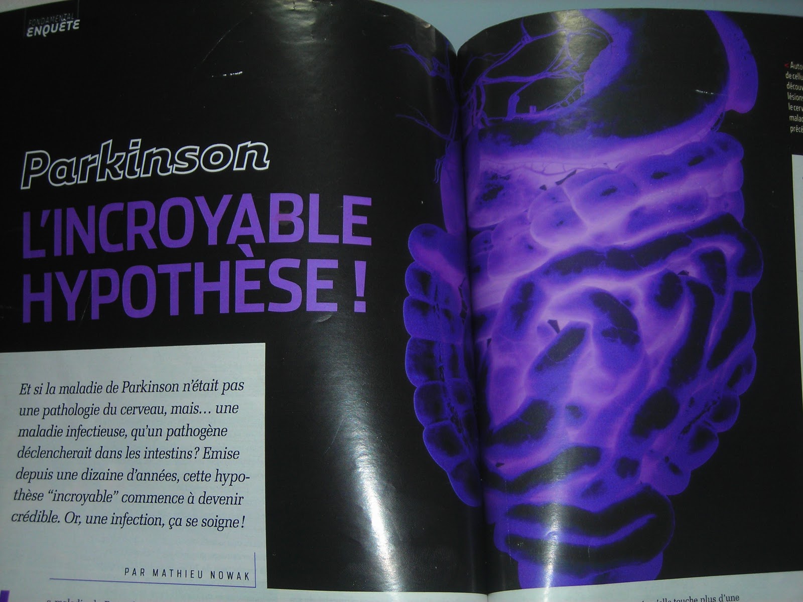 ciencia city: EL CEREBRO HUMANO Y LA INCREIBLE HIPOTESIS SOBRE EL PARKINSON