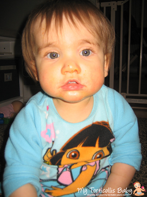 My Torticollis Baby: Tilt Regression (Milestone & Illness-Related)