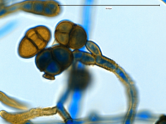 Fun With Microbiology (What's Buggin' You?): July 2015