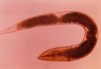 Pinworm (Enterobiasis) : Symptome Ursachen und Abhilfen