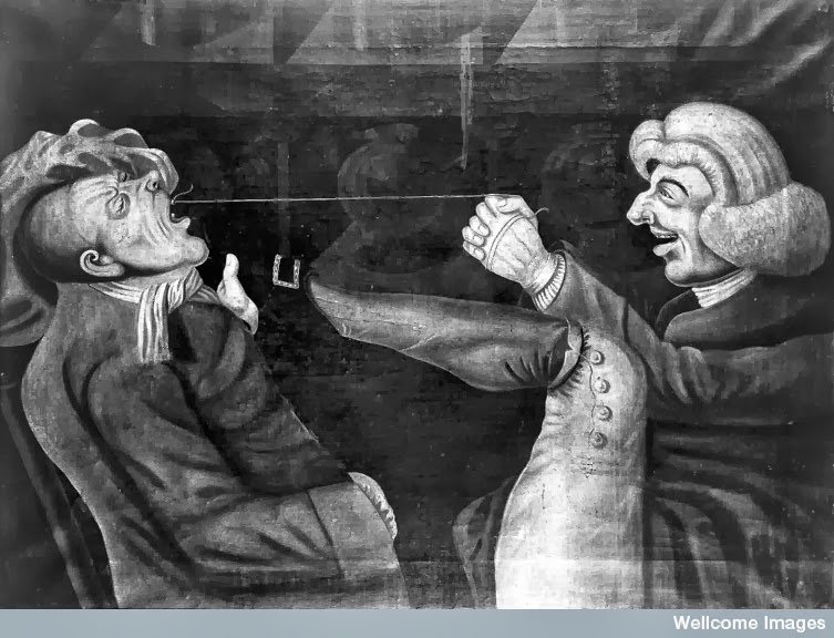 Old dental system ~ America Dental Care