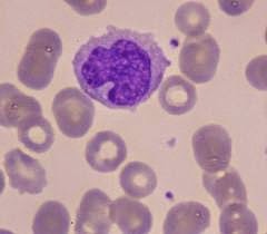 FICHERO DE HEMATOLOGÍA: primera parte