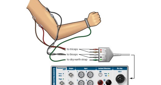 O QUE É ELETROMIOGRAFIA E PARA QUE ELA SERVE? – PARTE 1