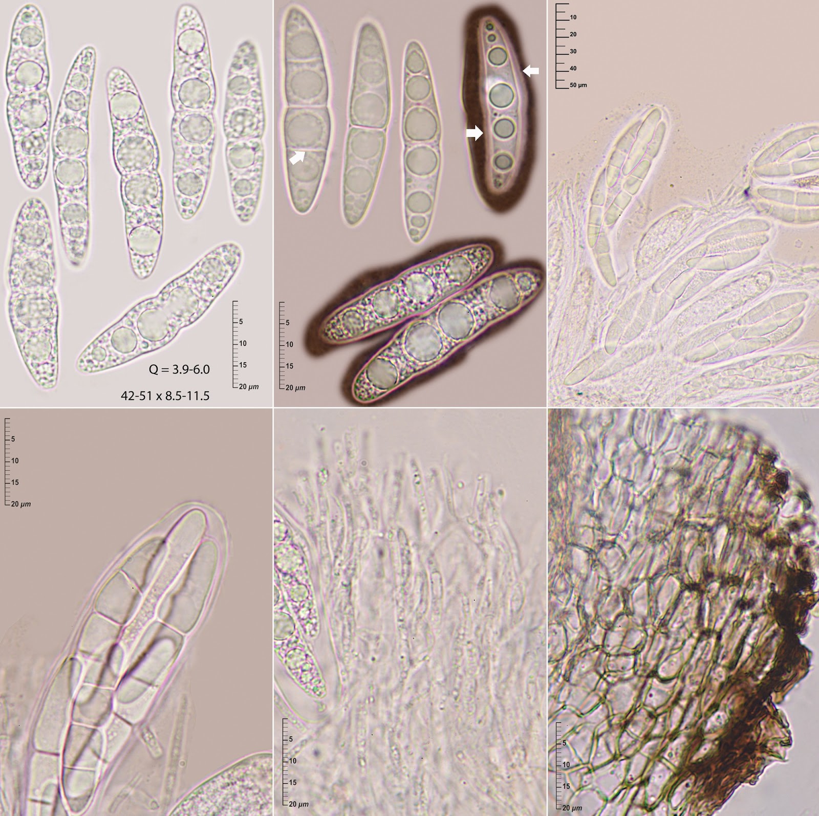 Lindgomyces griseosporus Ying Zhang, J. Fourn. & K.D. Hyde • CEMAS