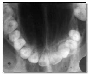 Dentistry and Medicine: Intraoral Radiographic Techniques (Intraoral ...