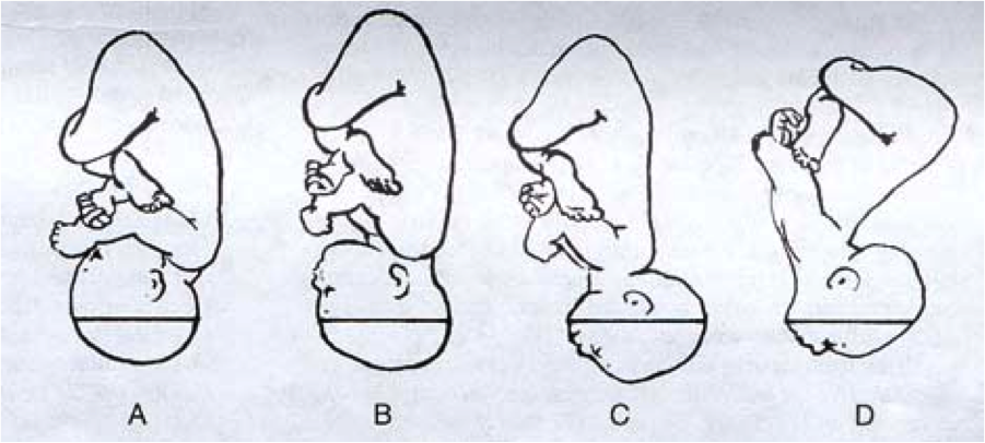 Ginecologia y Obstetricia: Estatica Fetal
