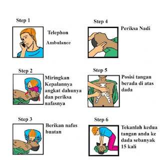 Hayatunnupus Haqiqi: Resusitasi Jantung Paru