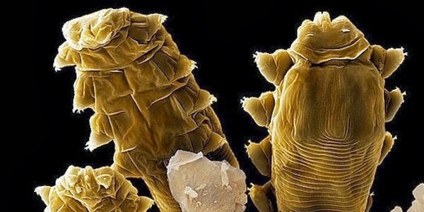 TENDANCE ANTIPODES: Demodex Folliculorum : un acarien qui vit sur notre ...