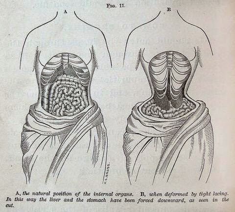 Photo: Just How Risky It Is To Go For Waist Training | TALKCRIB