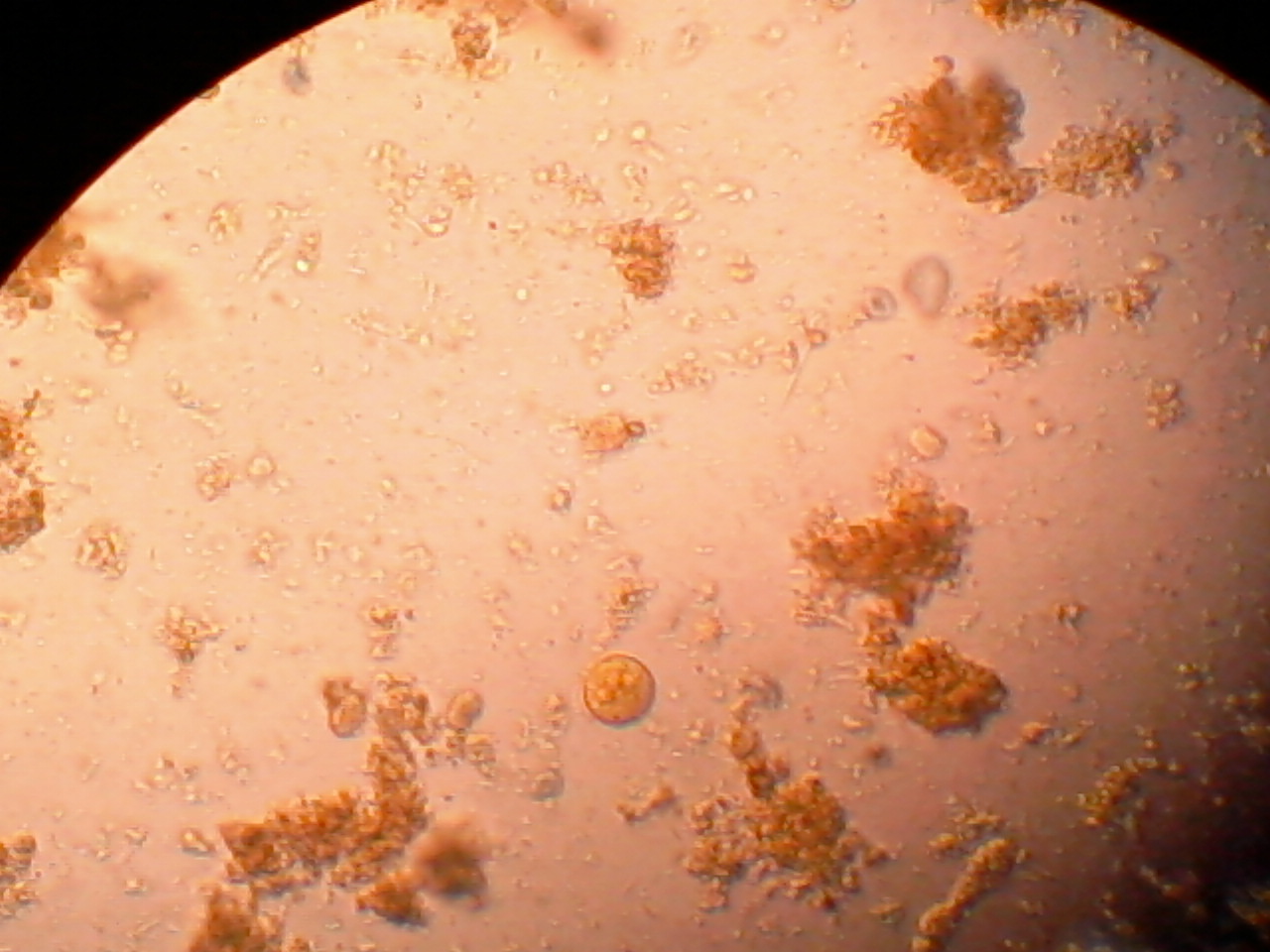 Parasitología Tecnologia Medica UST La Serena 2012: Quiste Entamoeba coli